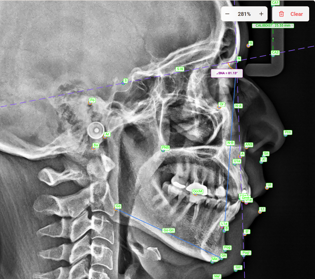 Cephometrix - AI-Powered Cephalometric Analysis for Orthodontists